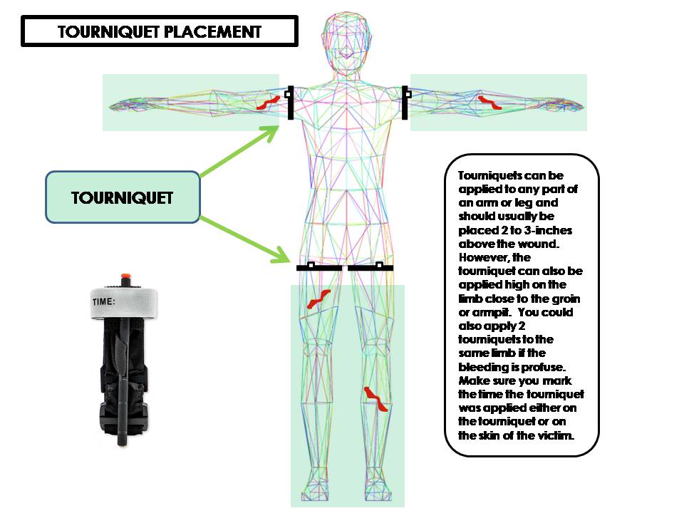 How to Stop Someone from Bleeding Out - Power Puff Protection