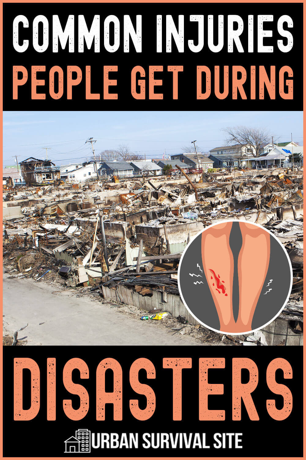 Common Injuries People Get During Disasters | Urban Survival Site